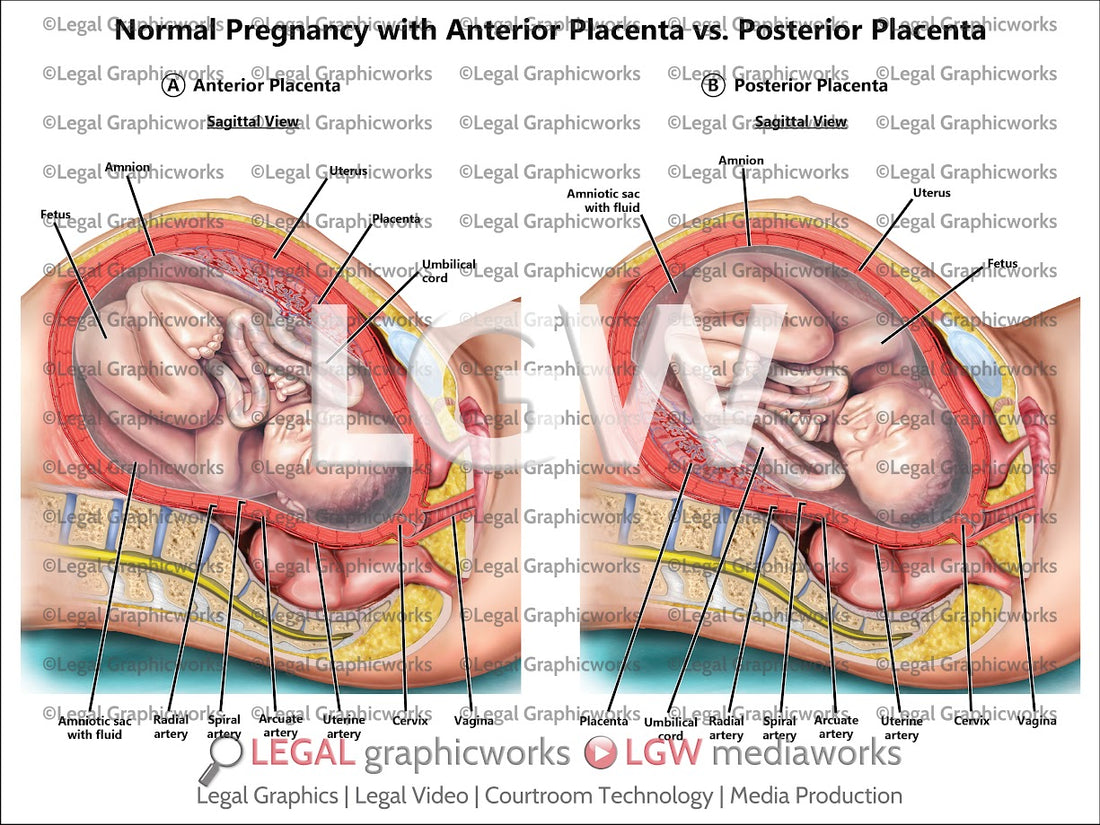 Normal Pregnancy with Anterior Placenta vs. Posterior Placenta – LGWgo